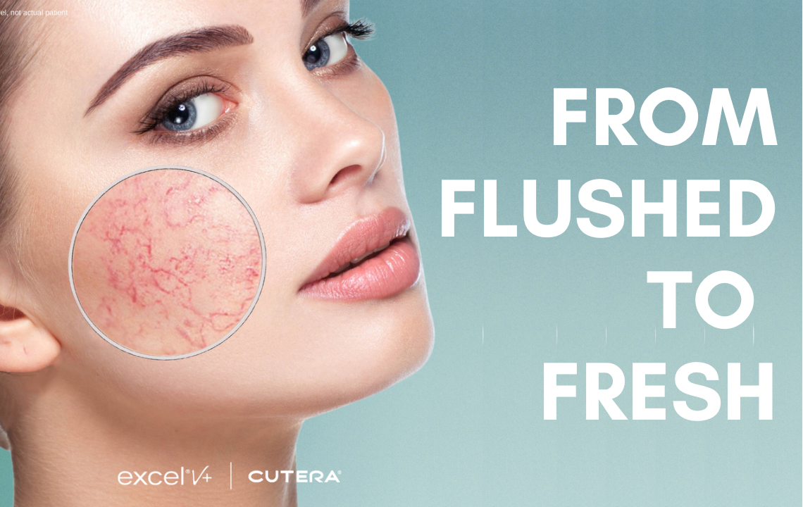 Why Your Facial Redness Won’t Go Away…And TheTreatment That Will ...